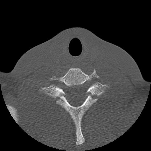 Cervical spine (neck) – Dr van Sittert